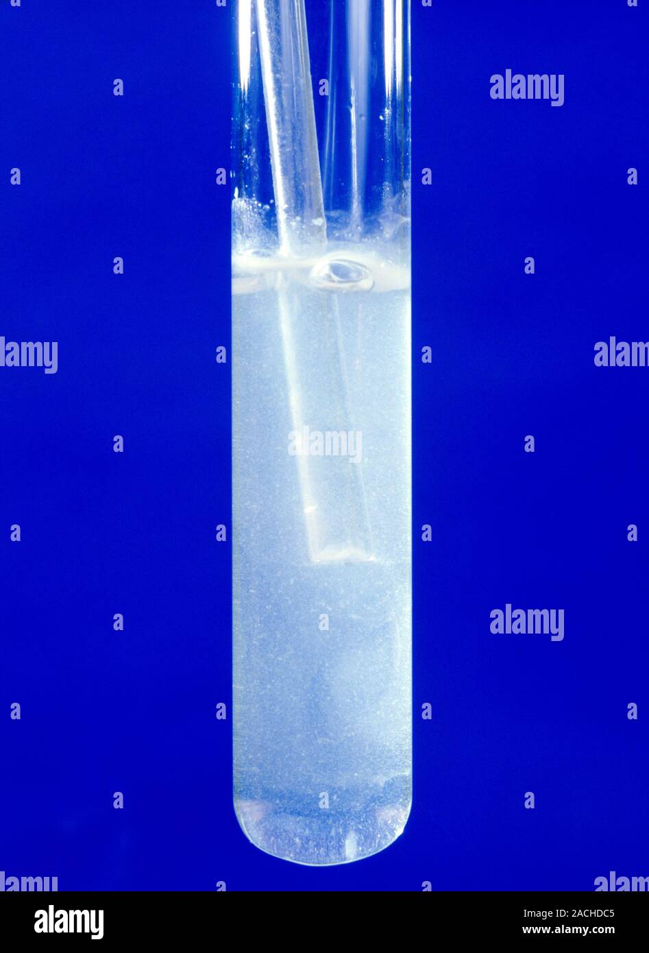 Precipitation reaction. Calcium carbonate (white) precipitating out of ...