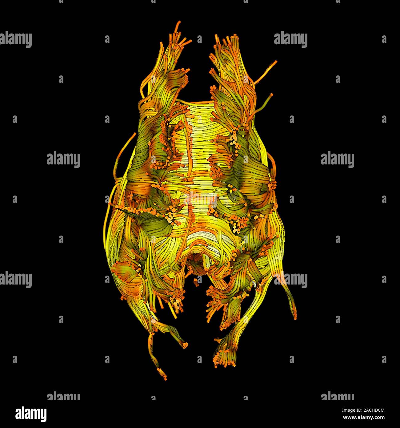 White matter fibres. Coloured 3D diffusion tensor imaging (DTI) scan of the bundles of white ...