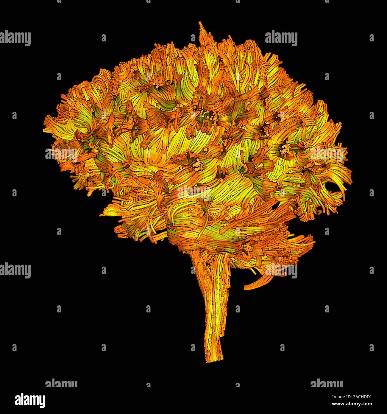 White matter fibres. Coloured 3D diffusion tensor imaging (DTI) scan of the brain, showing the ...