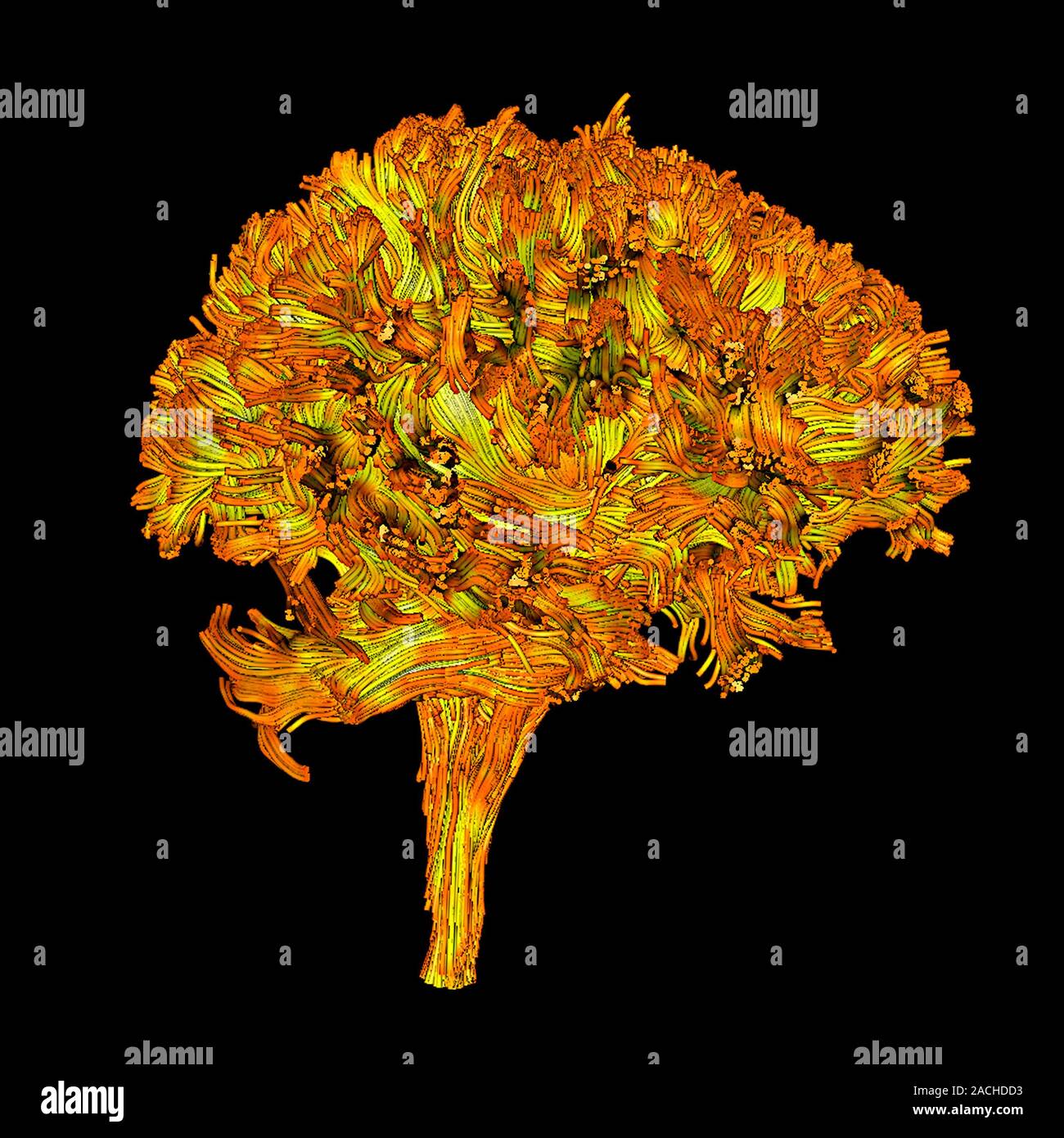 White matter fibres. Coloured 3D diffusion tensor imaging (DTI) scan of the brain, showing the ...