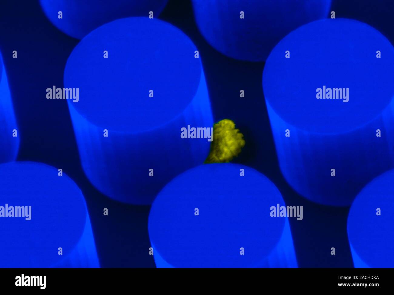 Cancer-detecting lab-on-a-chip. Coloured scanning electron micrograph ...