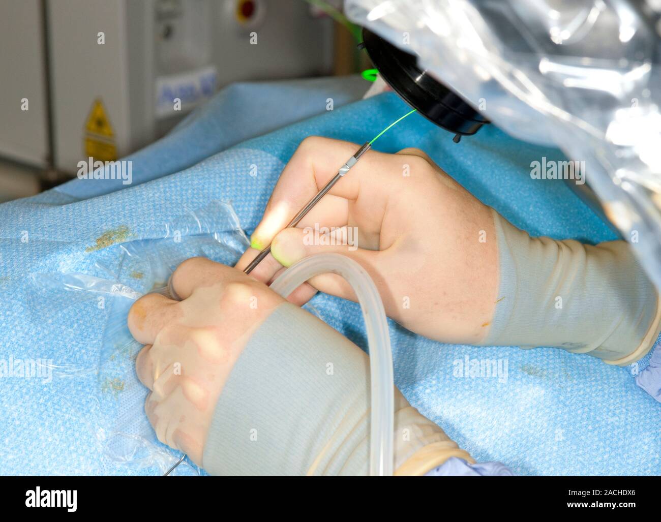Middle ear surgery. Surgeons operating on a patient's ear during a ...