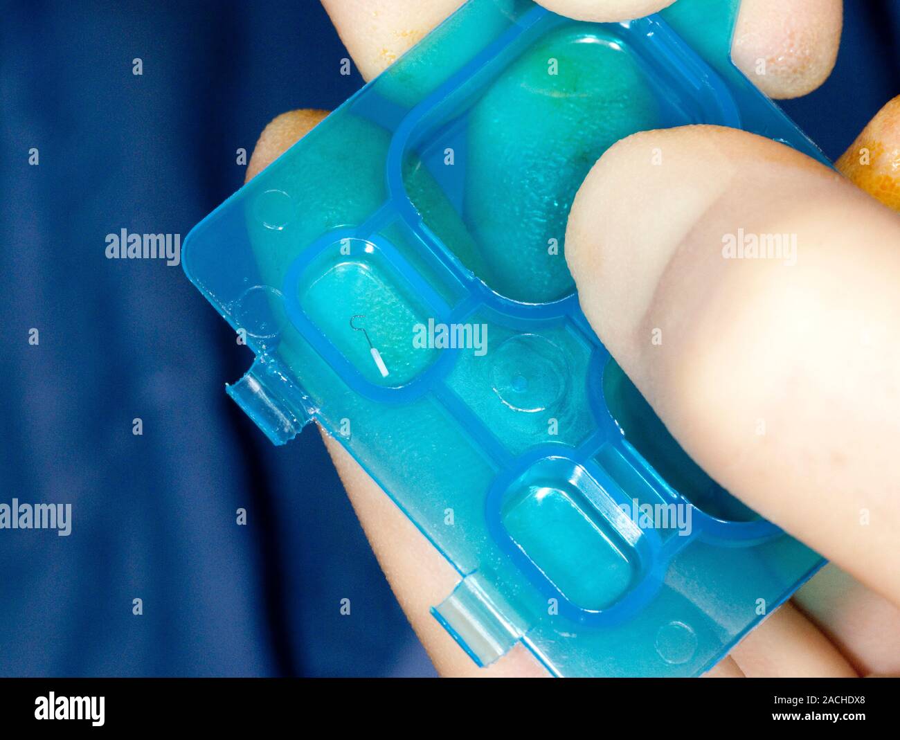 Middle ear surgery. Prosthesis (white with hook) ready to be implanted ...