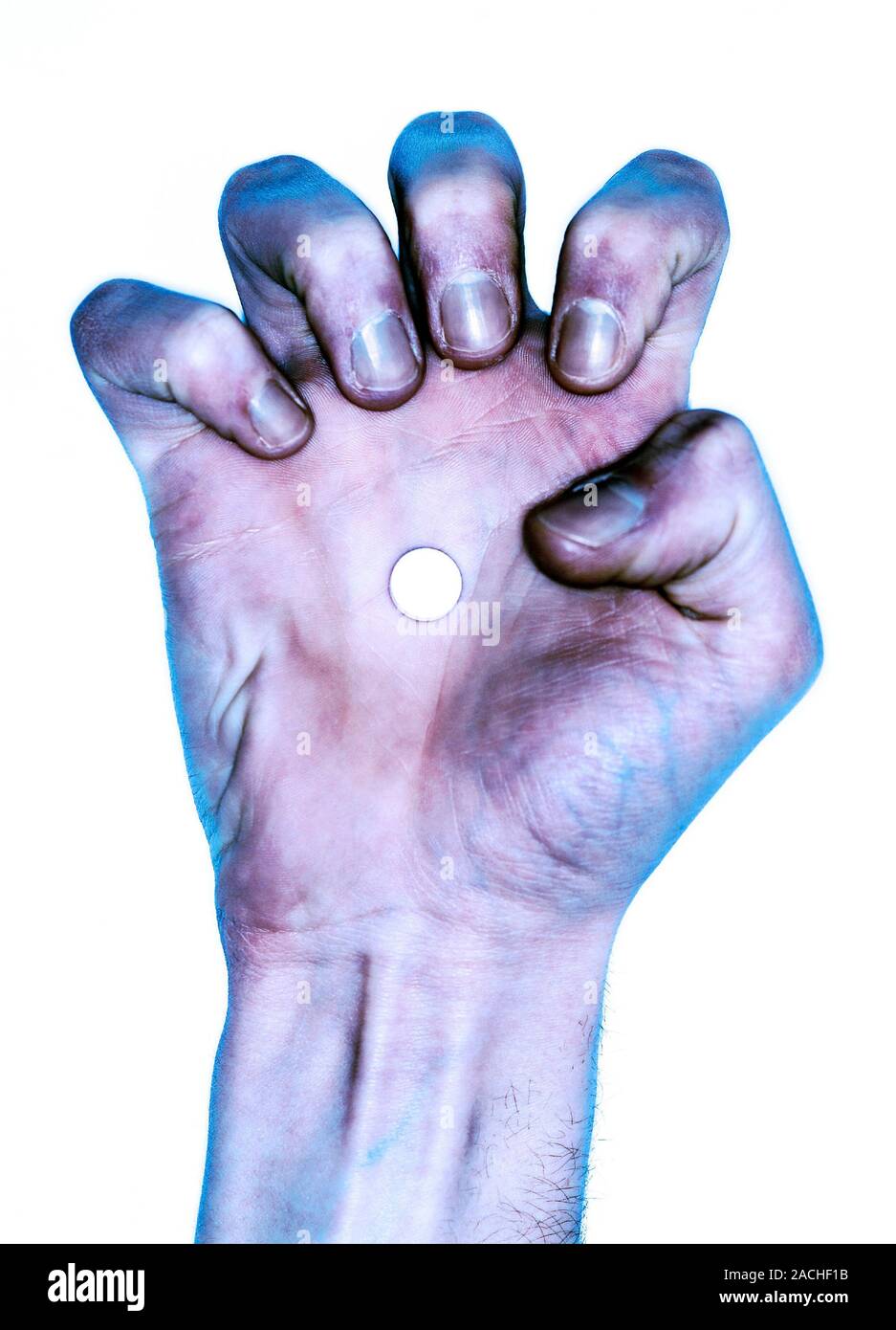 Drug addict, conceptual image. Hand clutching a pill, representing the ... Drug addict, conceptual image. Hand clutching a pill, representing the ...