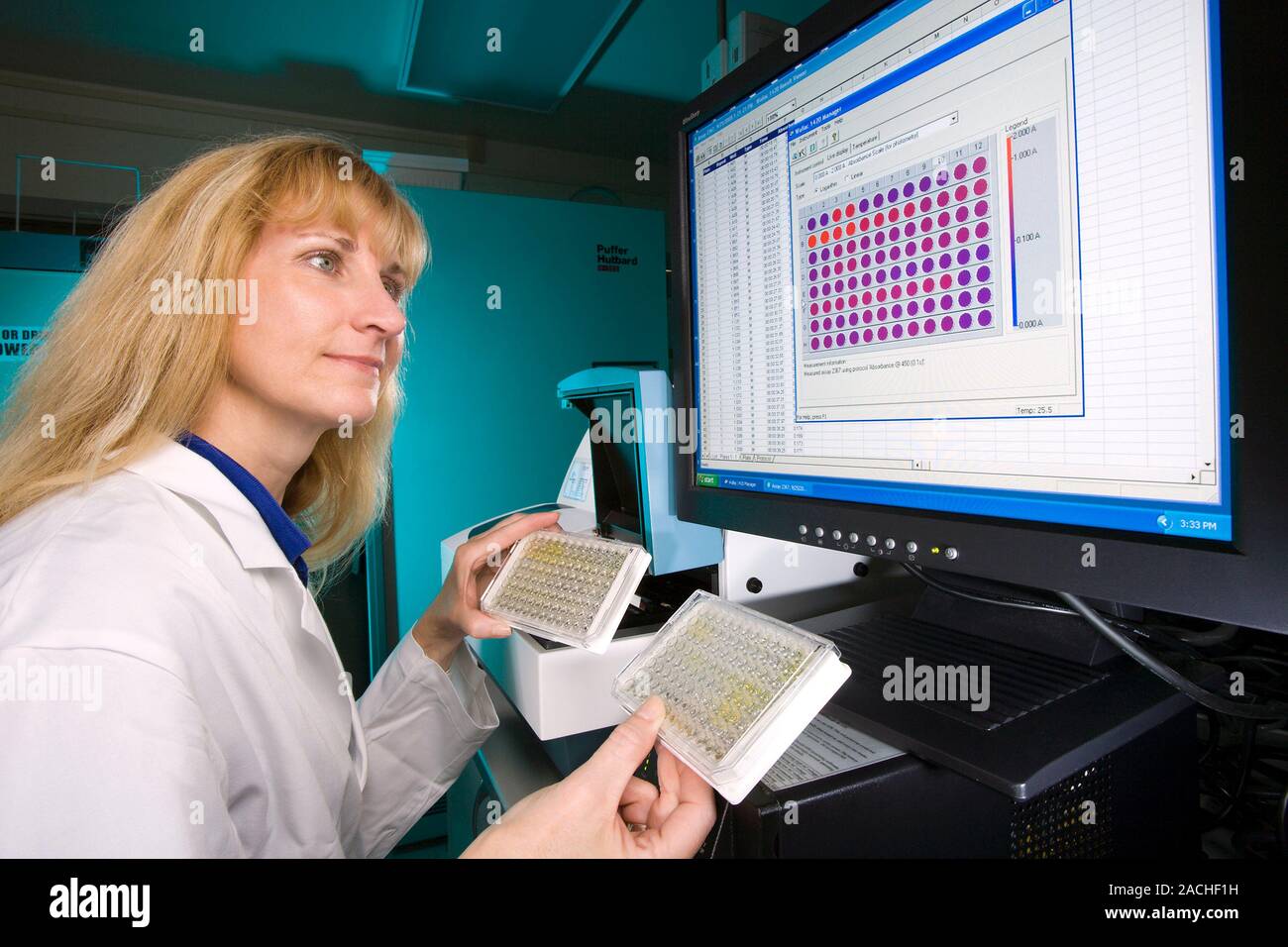 Immune test for Johne's disease. Microbiologist analysing results from ...