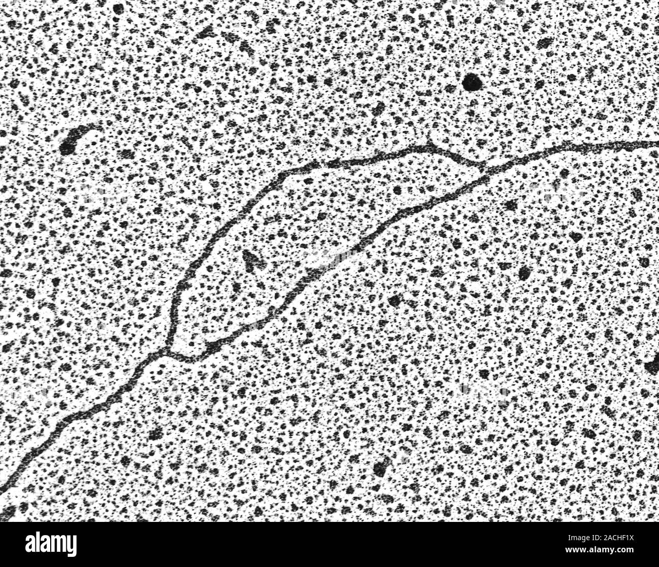DNA replication. Transmission electron micrograph (TEM) of human DNA ...