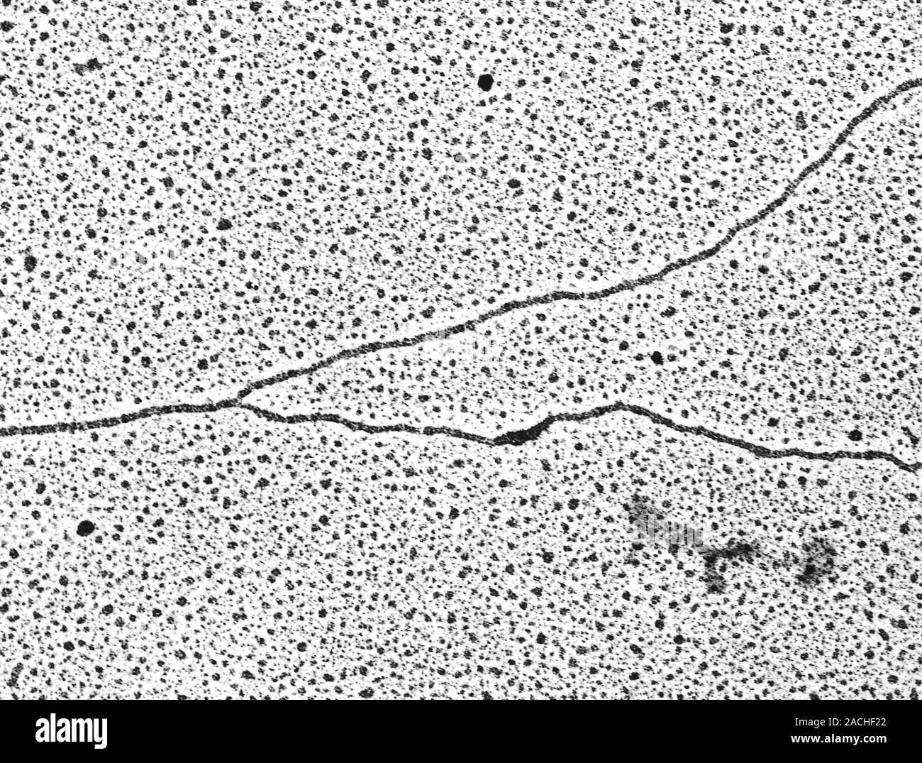 DNA replication. Transmission electron micrograph (TEM) of human DNA ...