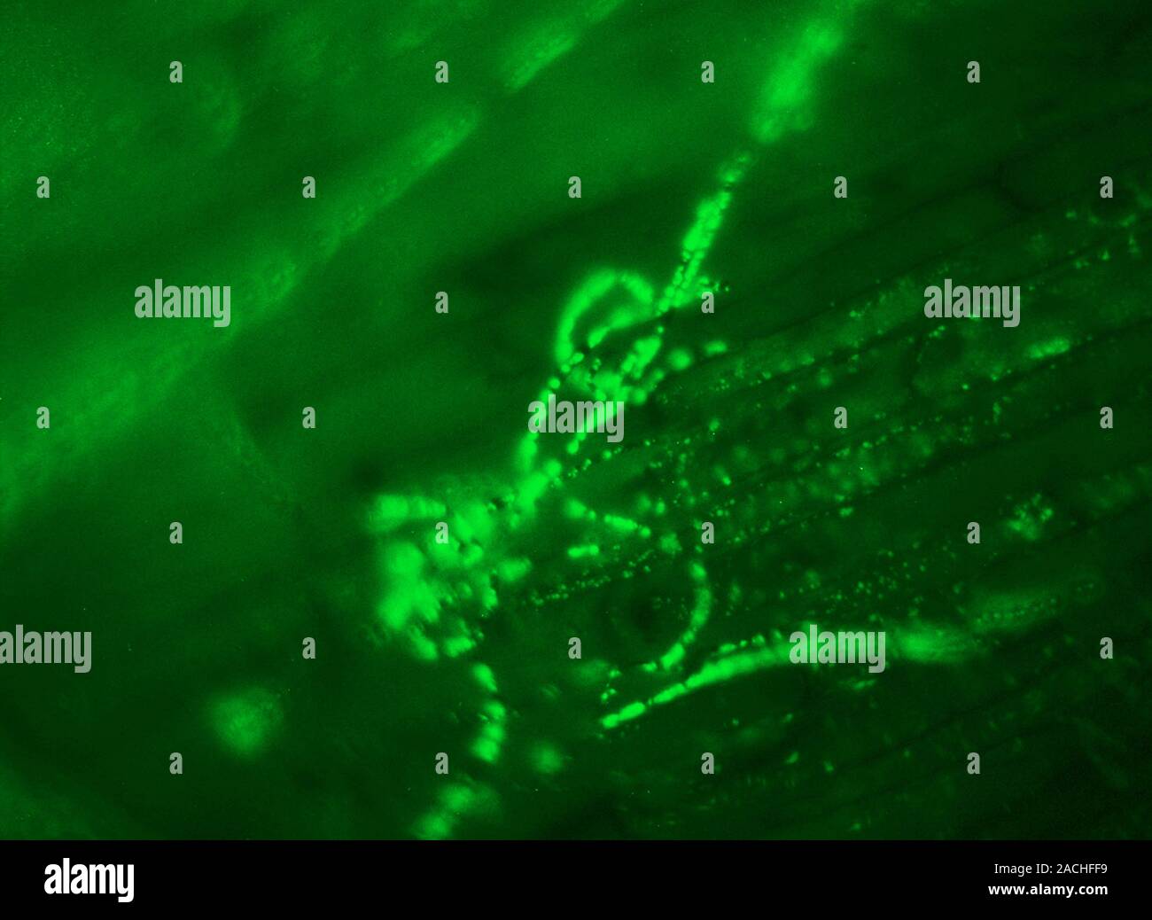 Metarhizium anisopliae fungus. Light micrograph of the parasitic fungus ...