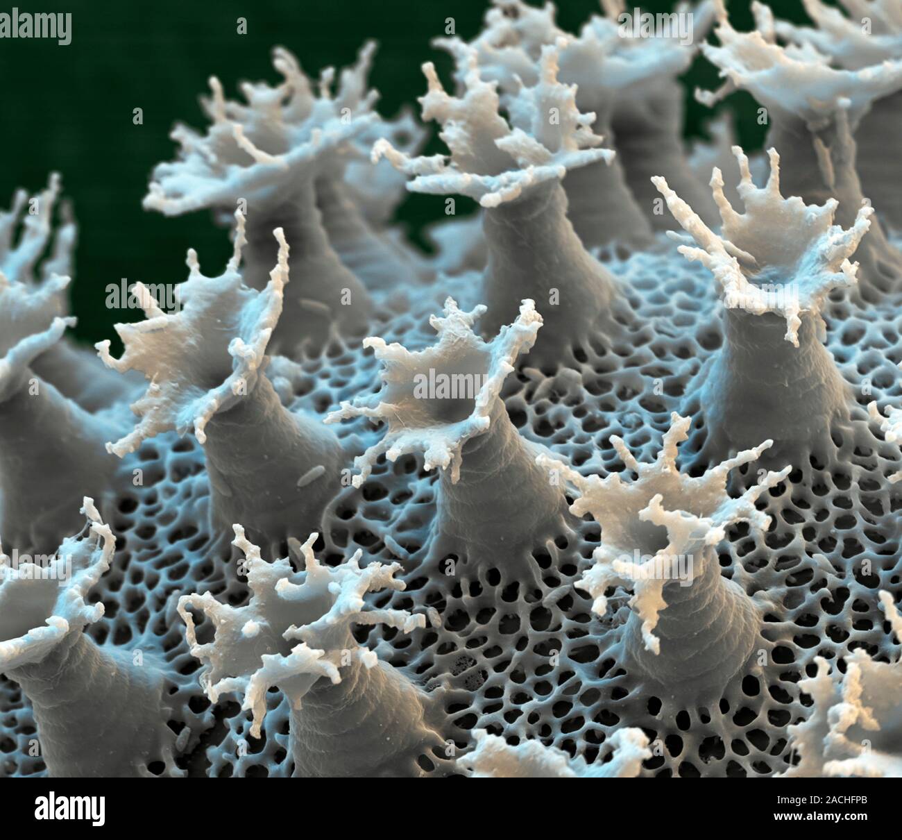 Water bear (Macrobiotus sapiens) egg, close up coloured scanning ...