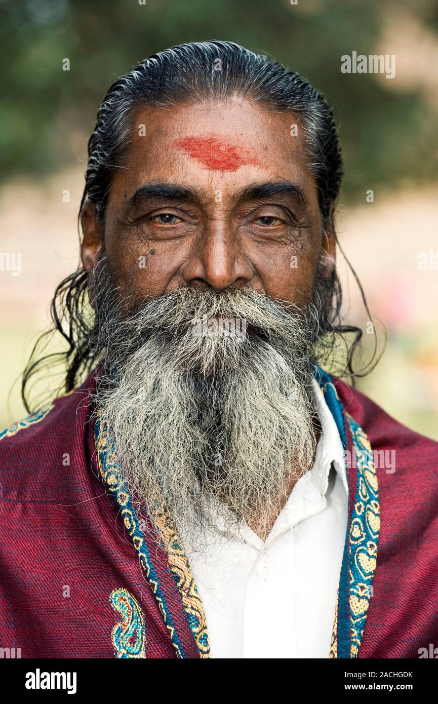 Elderly man with cataracts. A cataract is an opacity in the lens of the ...