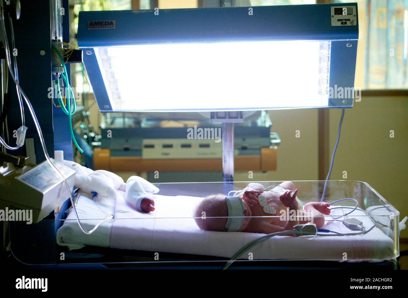 Premature baby under a light. Photographed in Belgium Stock Photo - Alamy
