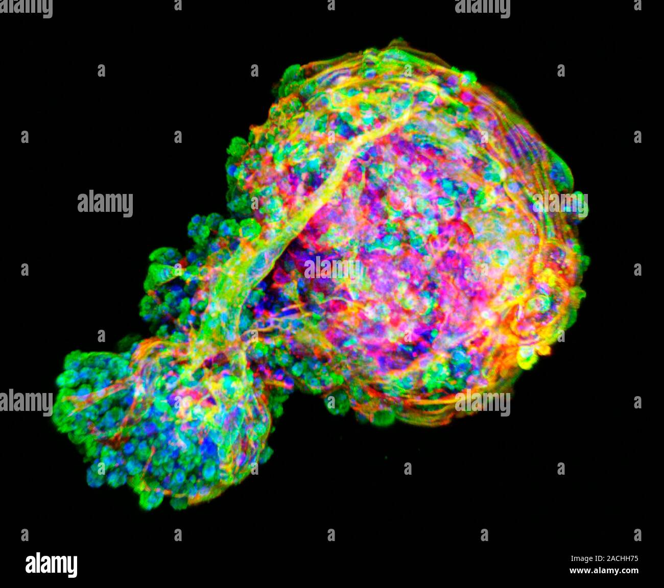 Embryoid bodies, fluorescent light micrograph. Embryoid bodies (EBs ...