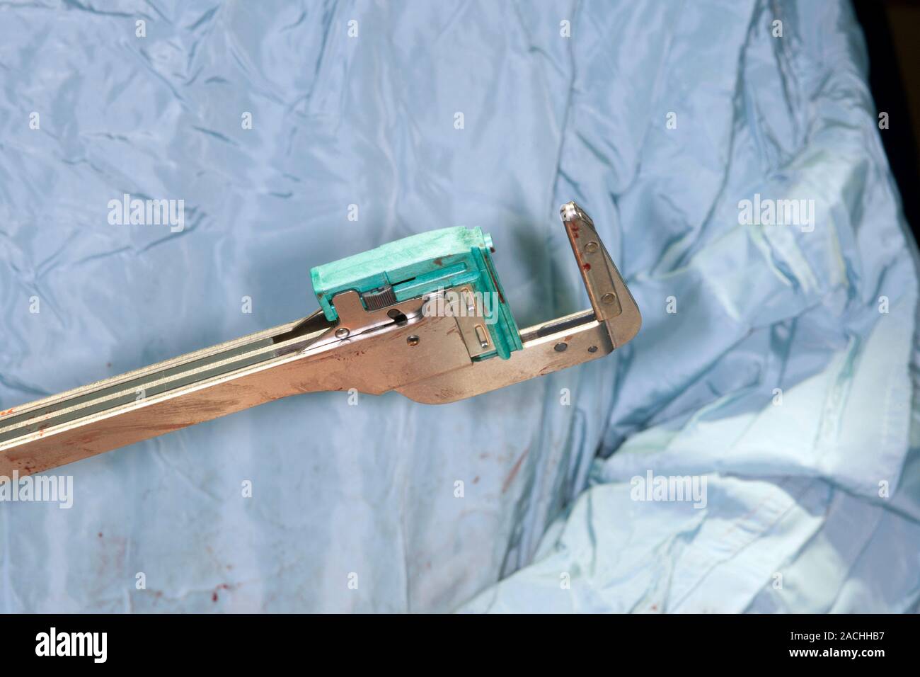 Bowel cancer surgery. Close-up of a clipping and stapling tool being ...