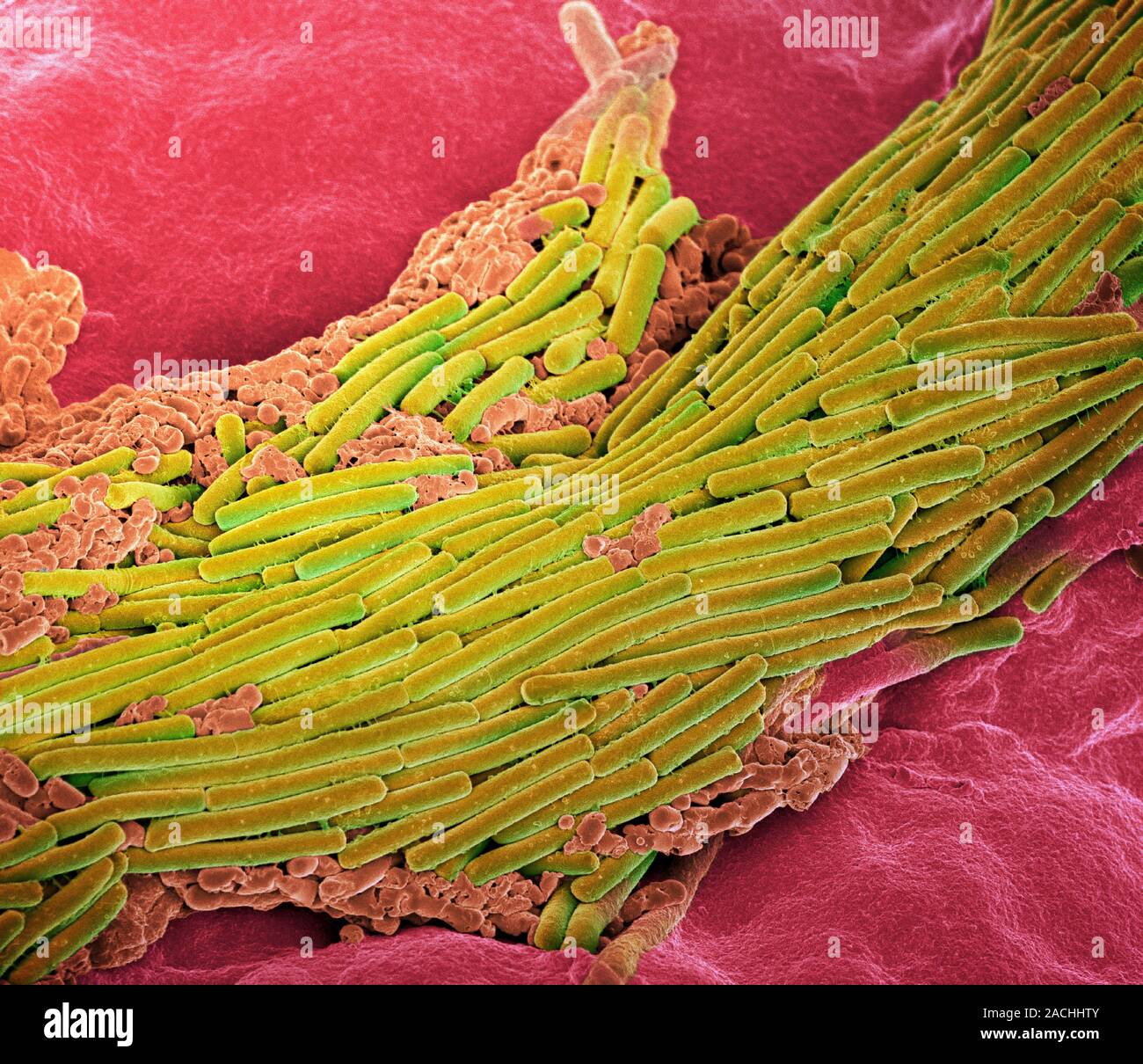 Clostridium difficile bacteria. Coloured scanning electron micrograph ...