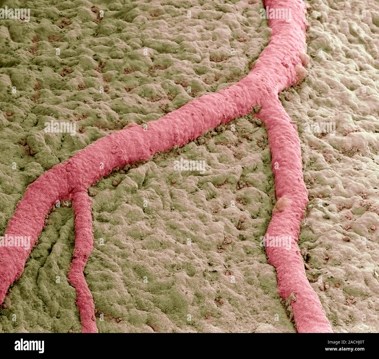 Amnion surface. Coloured scanning electron micrograph (SEM) of a blood ...