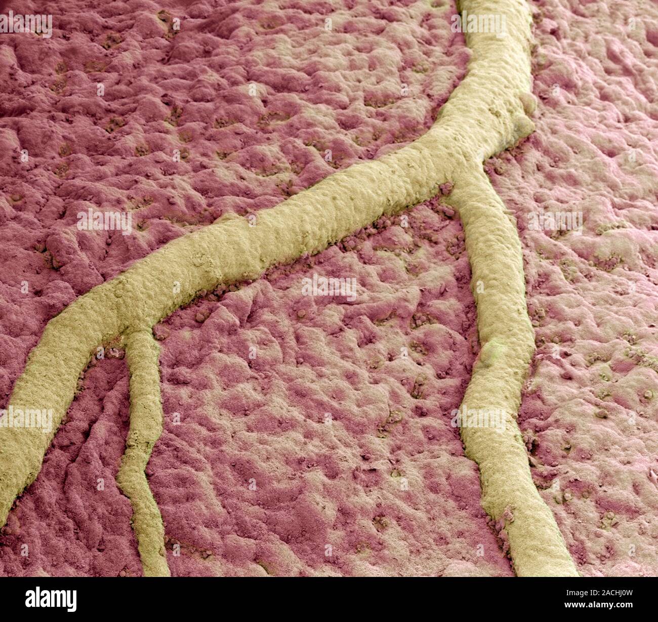 Amnion surface. Coloured scanning electron micrograph (SEM) of a blood ...