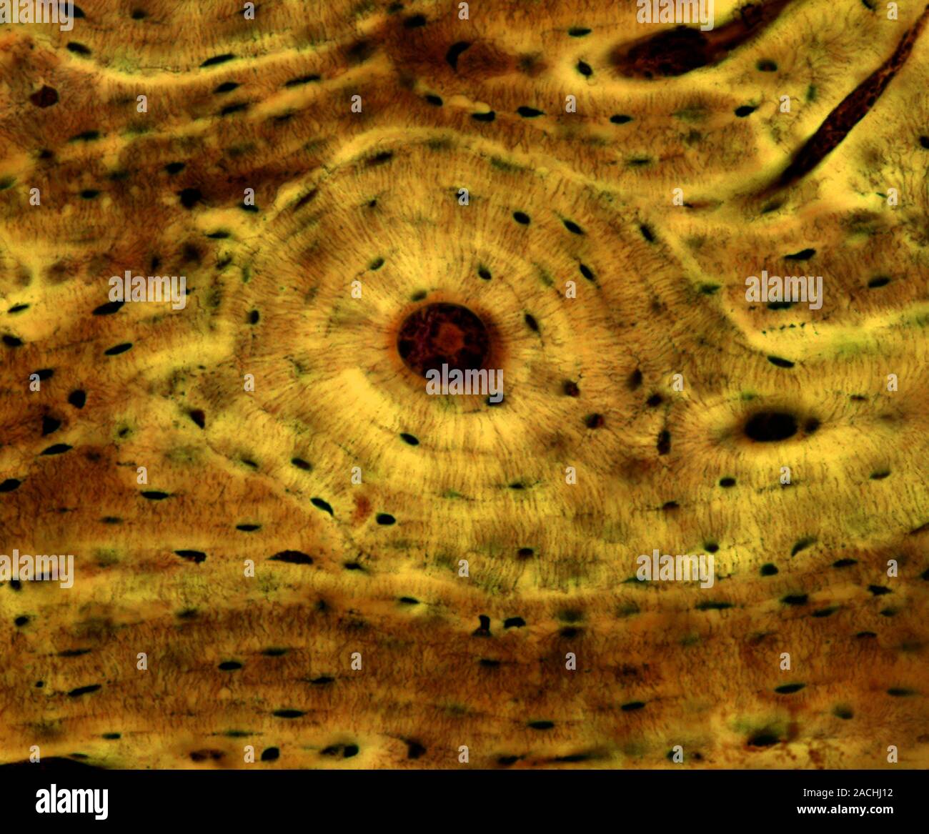 Compact bone, light micrograph. Compact bone consists of concentric ...