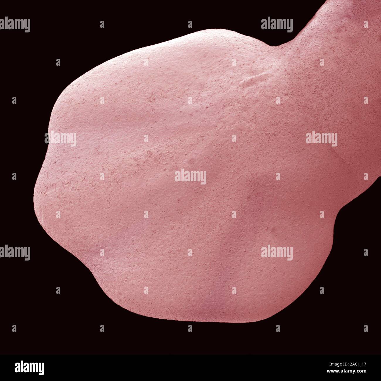 Cat foetus. Coloured scanning electron micrograph (SEM) of the front ...