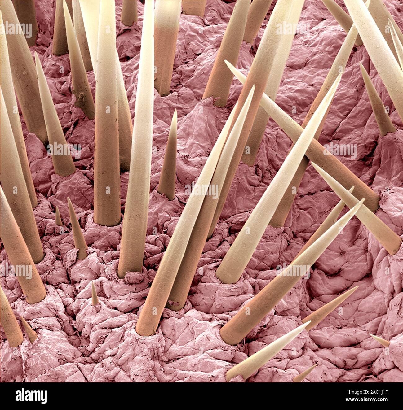 Hedgehog spines, coloured scanning electron micrograph (SEM). A spine ...