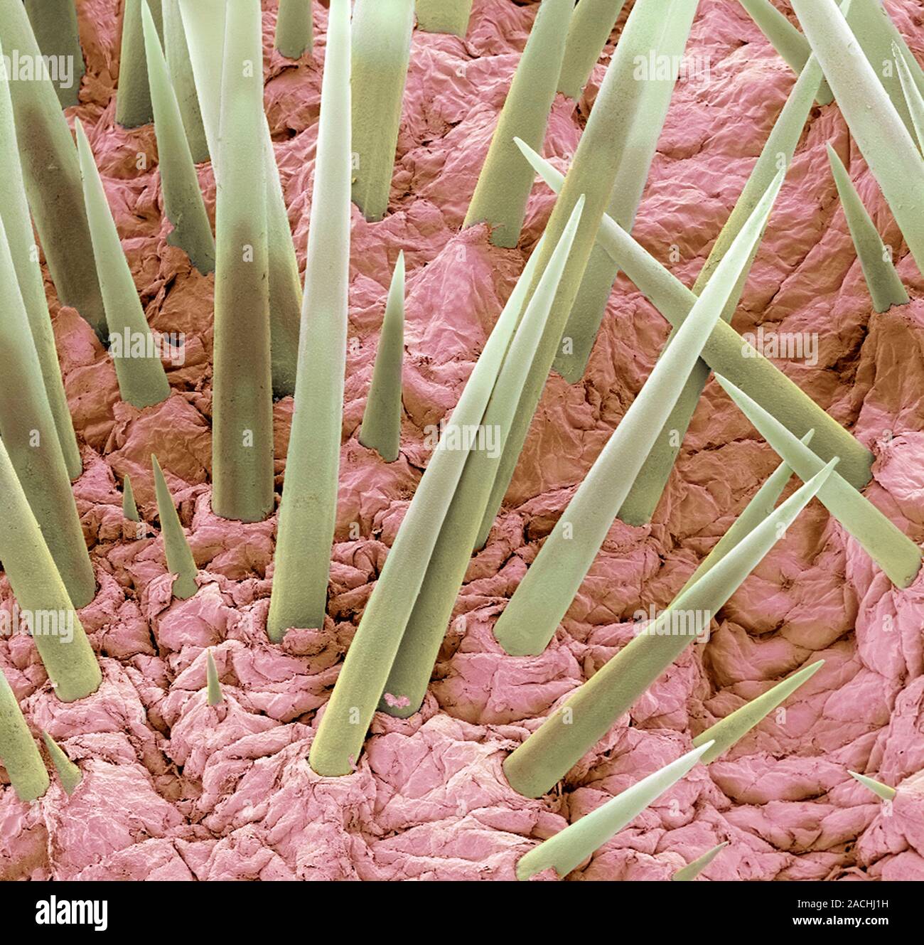 Hedgehog spines, coloured scanning electron micrograph (SEM). A spine ...
