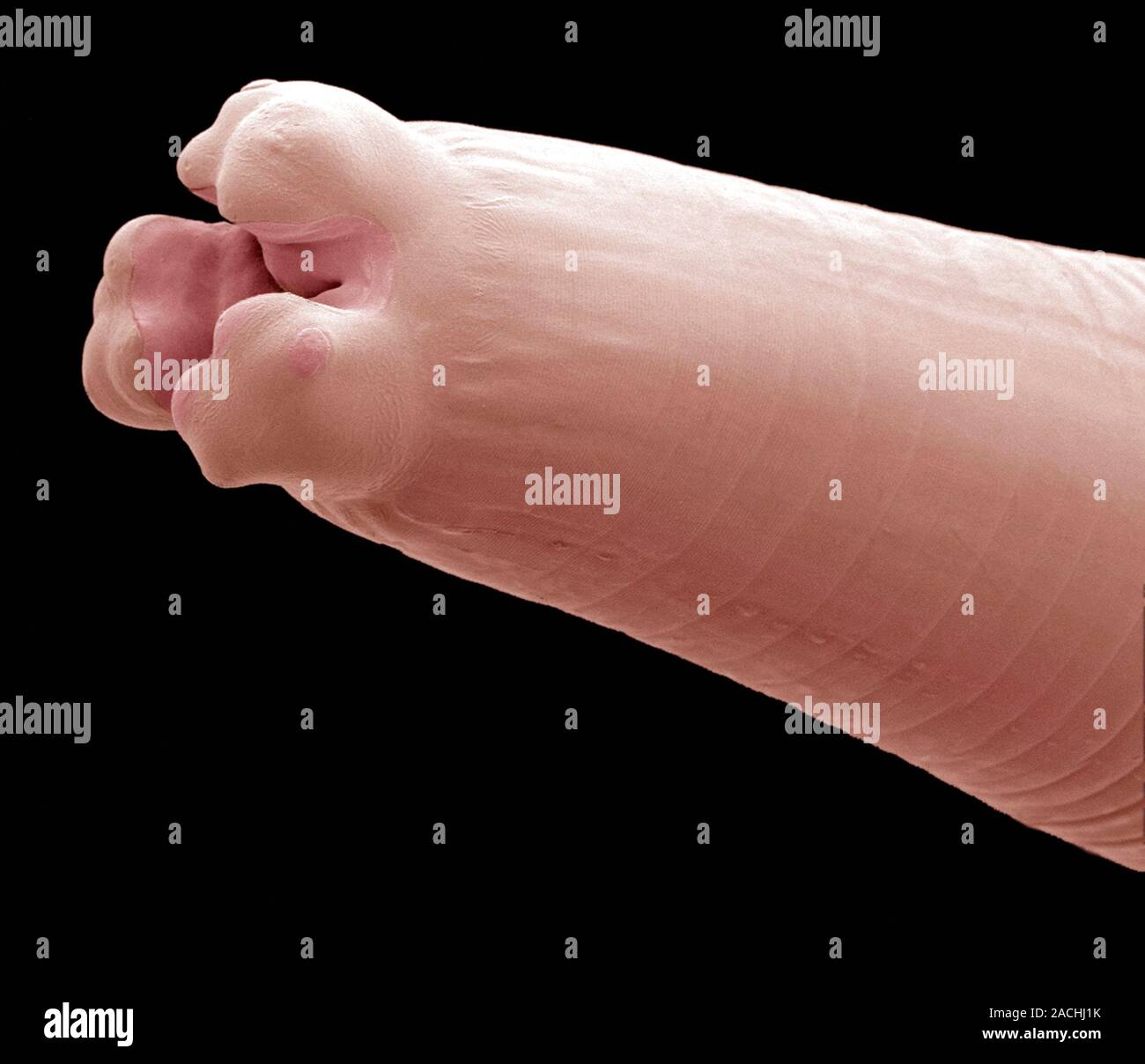 Threadworm. Coloured scanning electron micrograph (SEM) of the head of ...