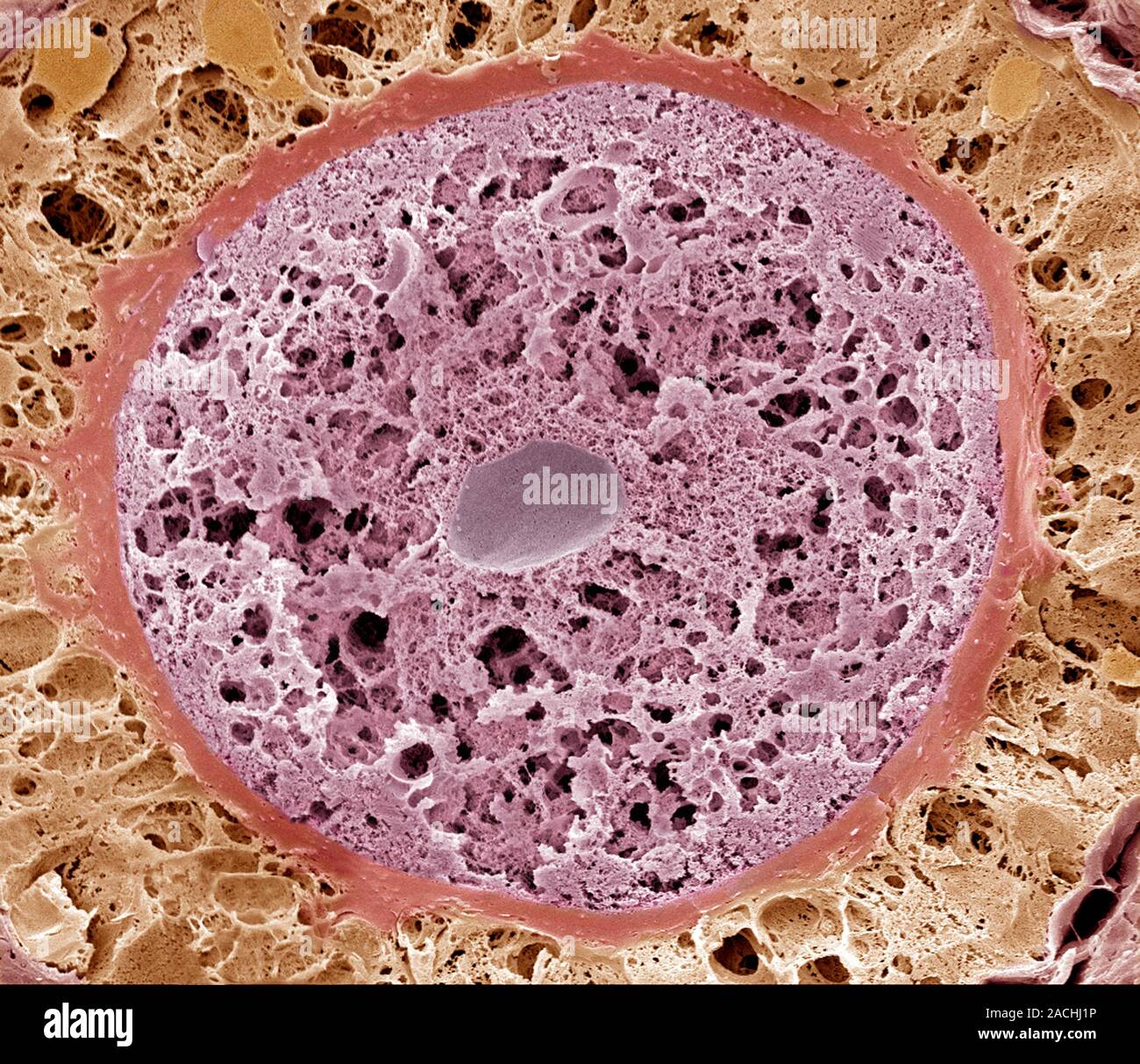 Ovarian follicle. Coloured scanning electron micrograph (SEM) of a ...