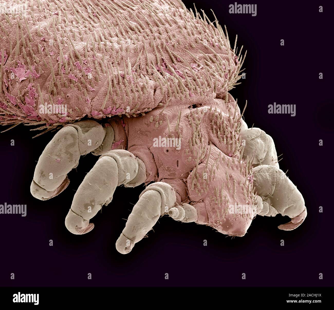 Seal louse (Echinophthirius horridus), coloured scanning electron ...