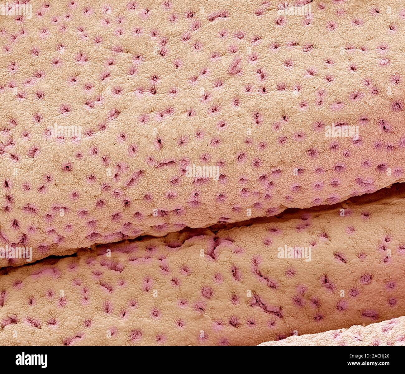 Uterine lining. Coloured scanning electron micrograph (SEM) of the ...