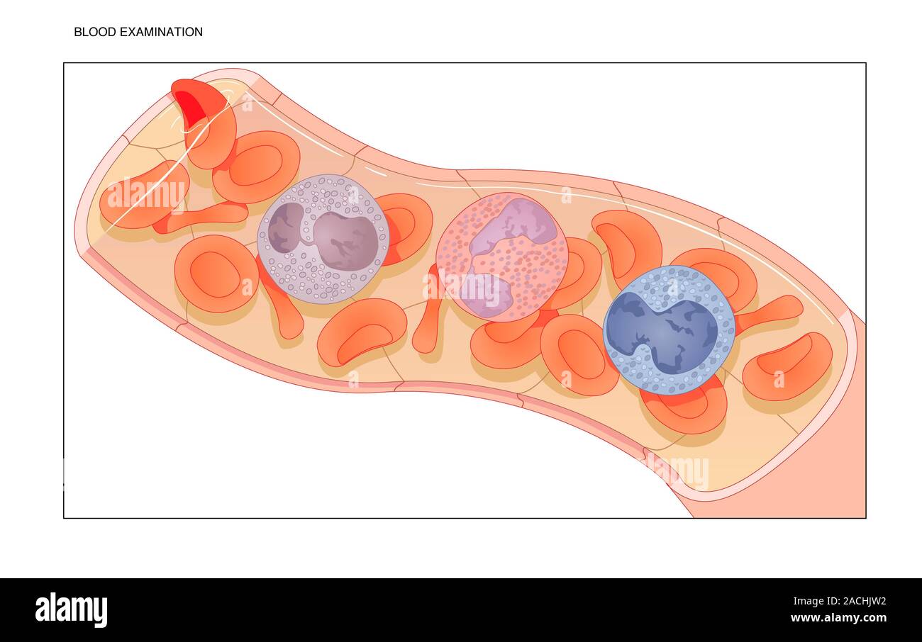 Blood cells. Cut-away artwork of a blood vessel showing the blood cells ...