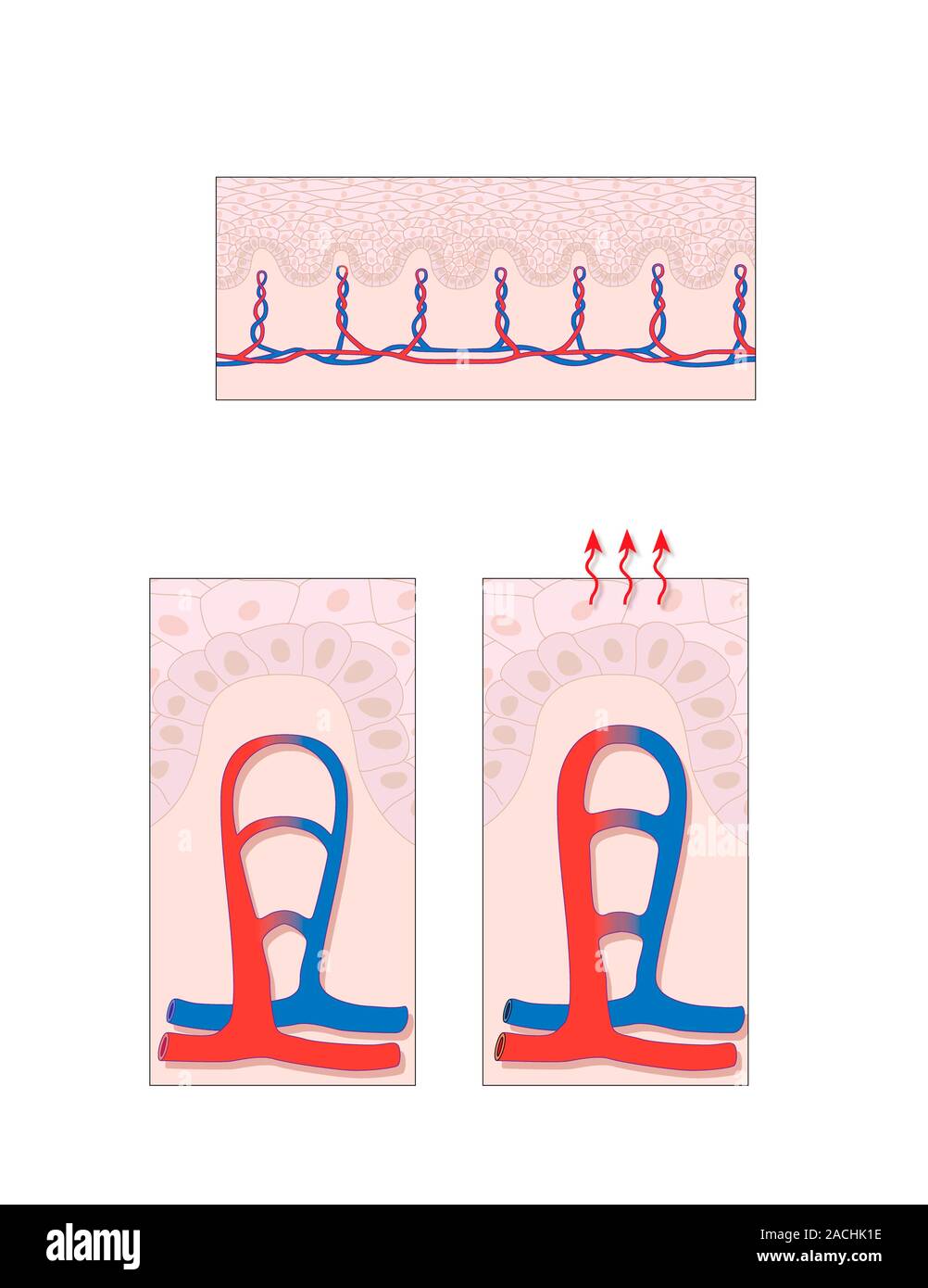 Vasoconstriction. Artwork showing blood vessels in the skin responding ...