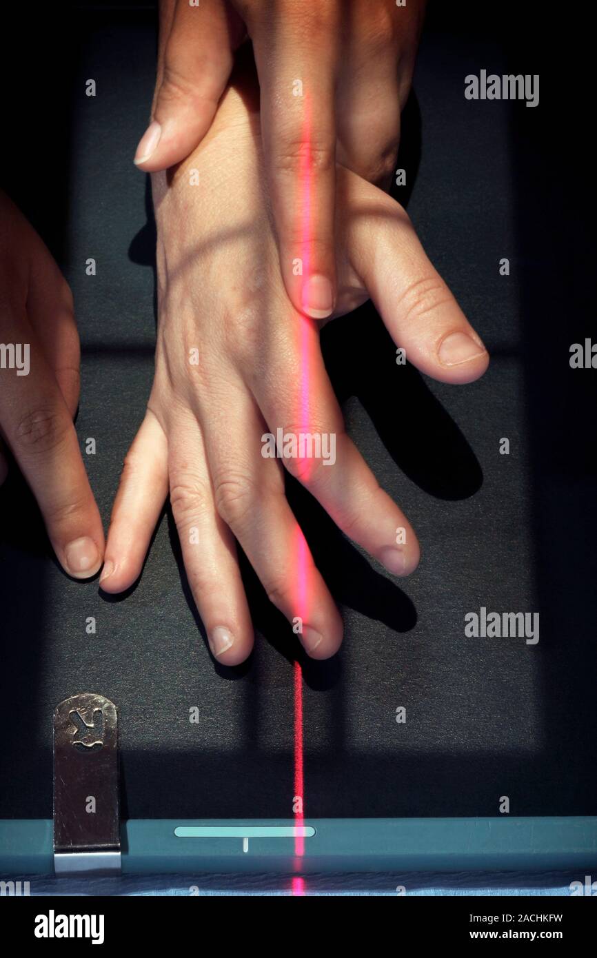Hand X-ray. Radiographer placing a patient's hand in the correct ...