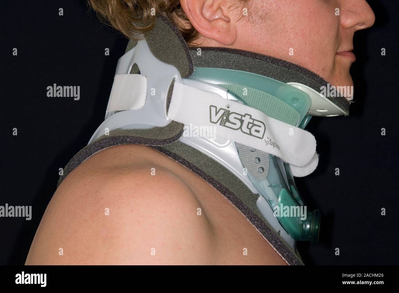 Side view of the hard neck collar worn by a 26 year old male patient to ...