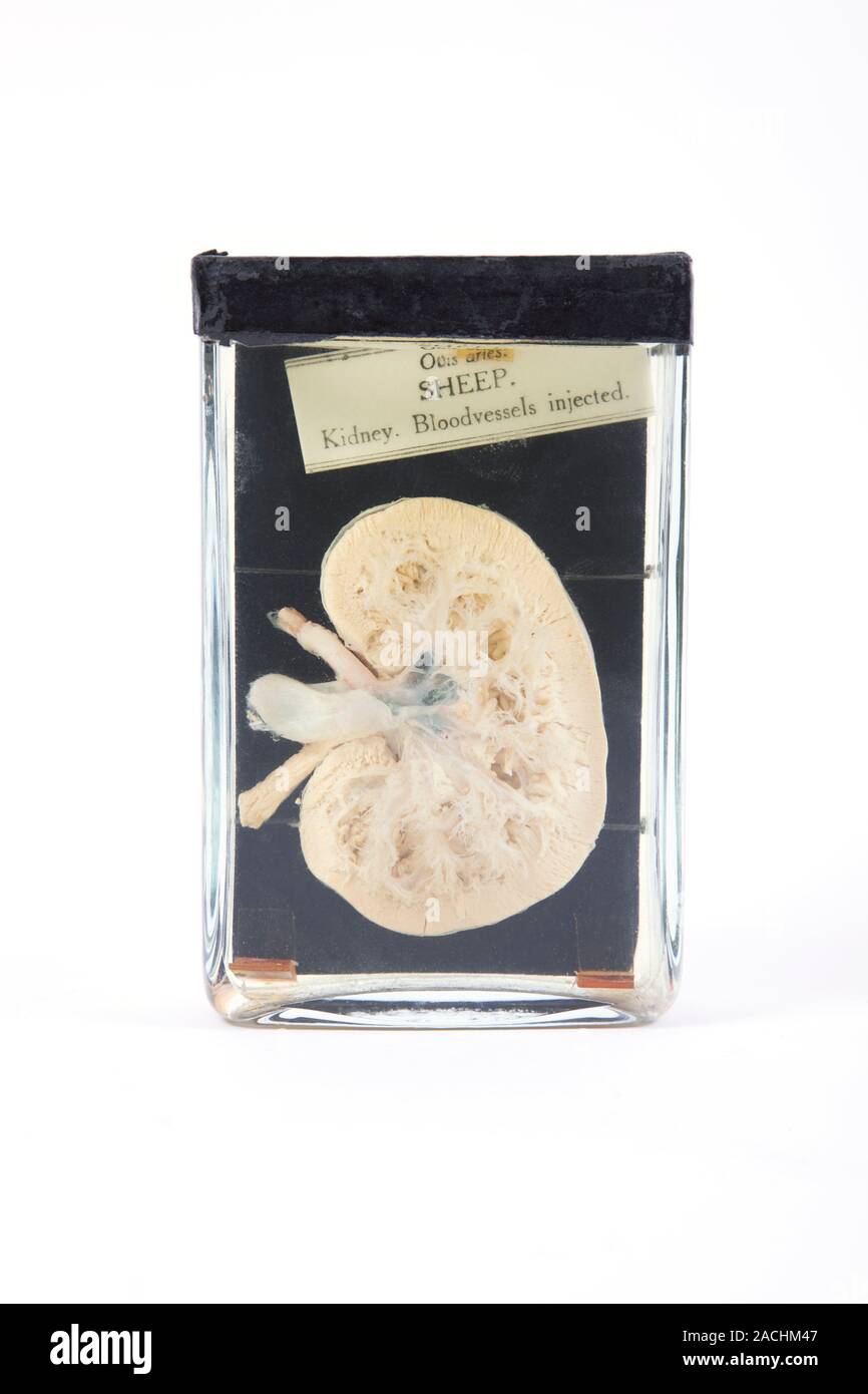 Sheep's kindey. Dissected sheep's kidney preserved in a jar Stock Photo ...