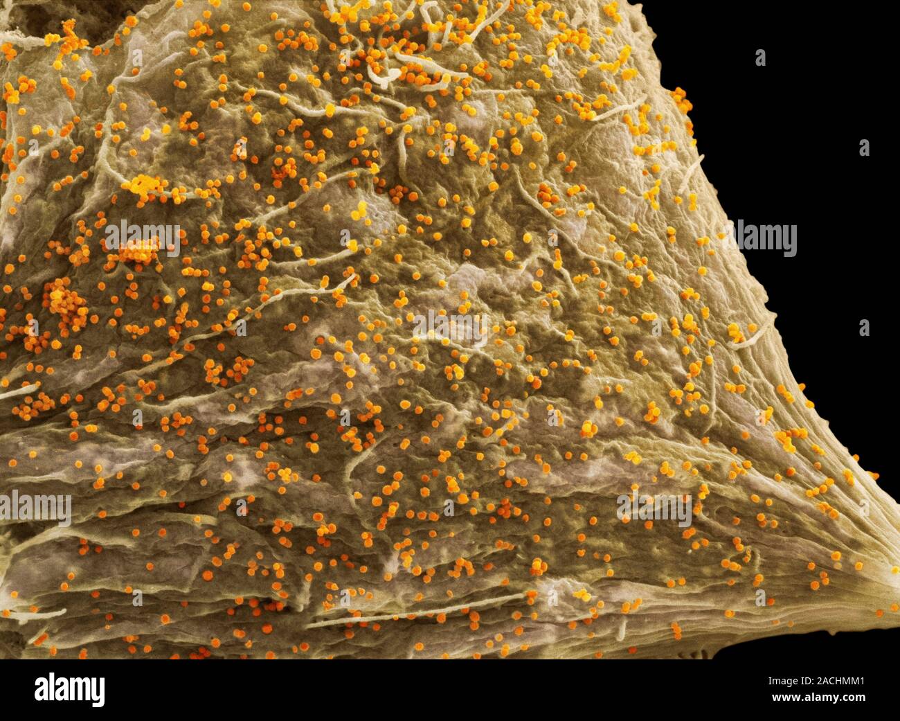 Cell infected with HIV. Coloured scanning electron micrograph (SEM) of ...