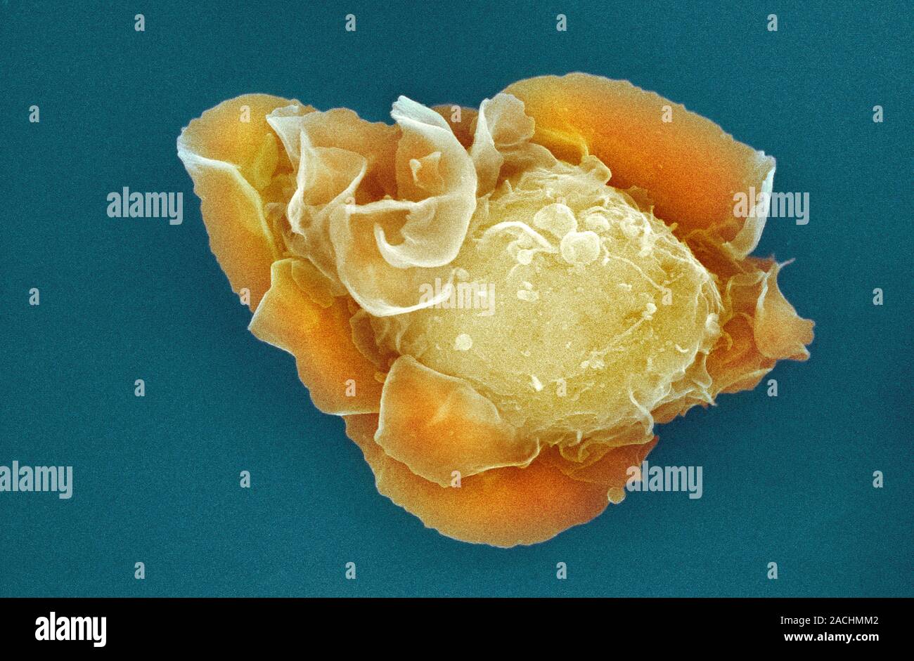 Stem cell, coloured scanning electron micrograph (SEM). Stem cells can ...