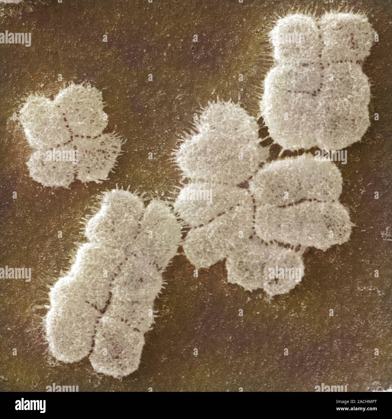 Human chromosomes, coloured scanning electron micrograph SEM ...