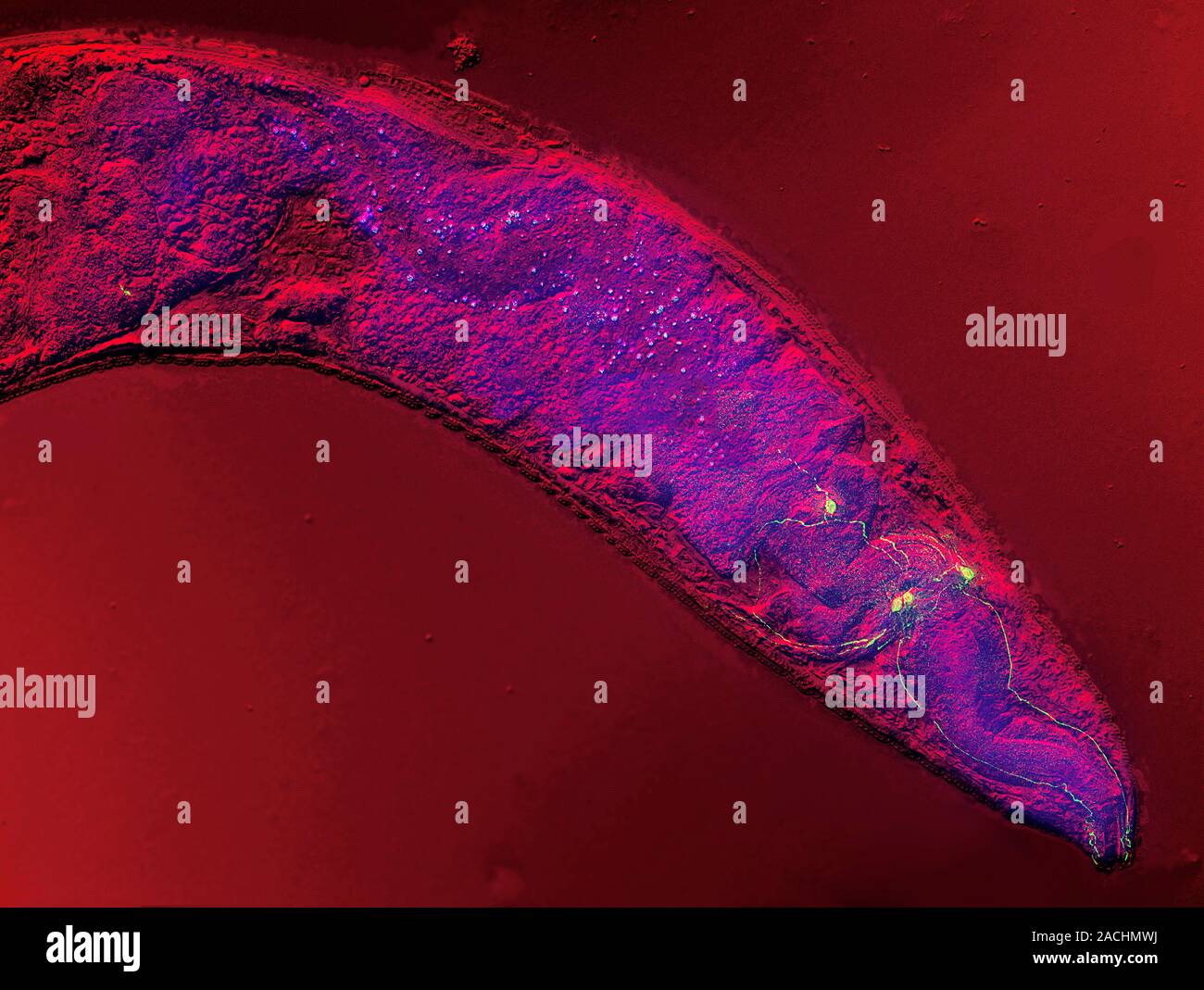 Caenorhabditis elegans. Fluorescence micrograph of the transparent nematode (roundworm) worm ...