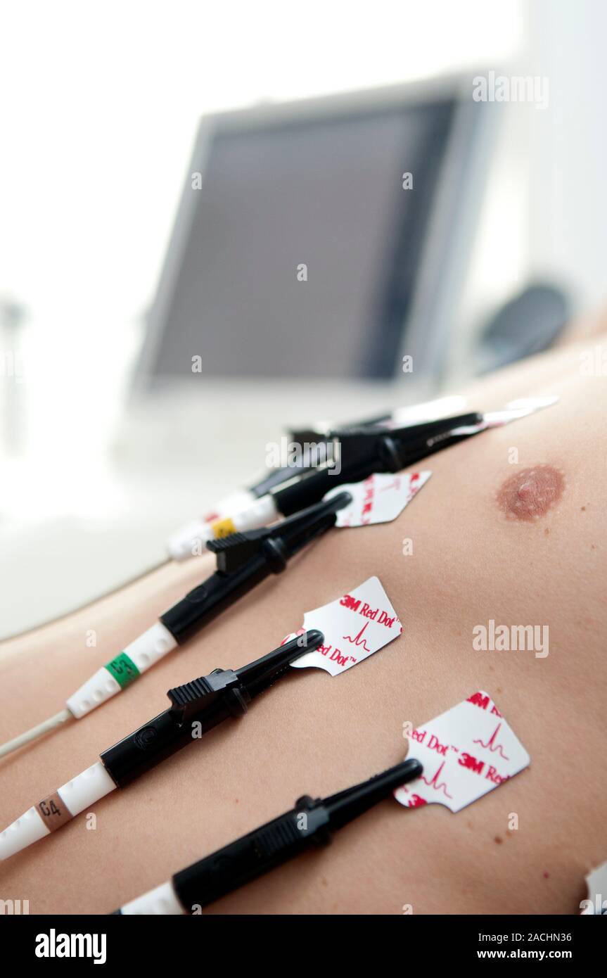 Heart monitoring. Close-up of a patient undergoing an ...