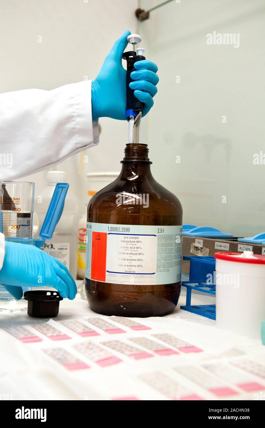 Cardiology research. Researcher in a cardiology laboratory pipetting ...
