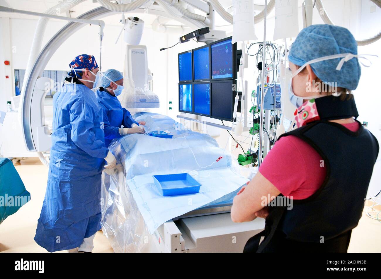 Aneurysm surgery. Surgical team removing an aneurysm in a patient's ...