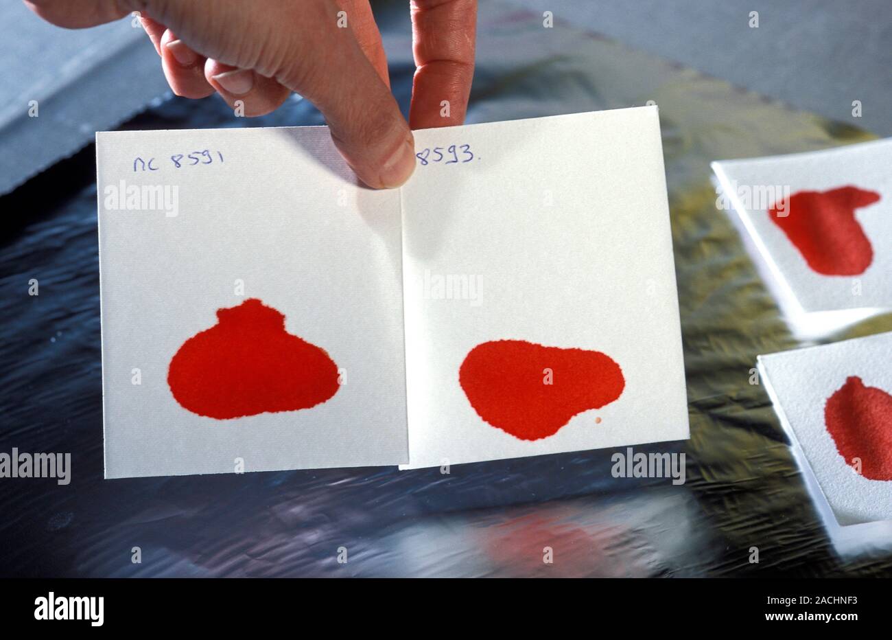 Blood analysis. Blood samples on absorbent paper ready for biological ...