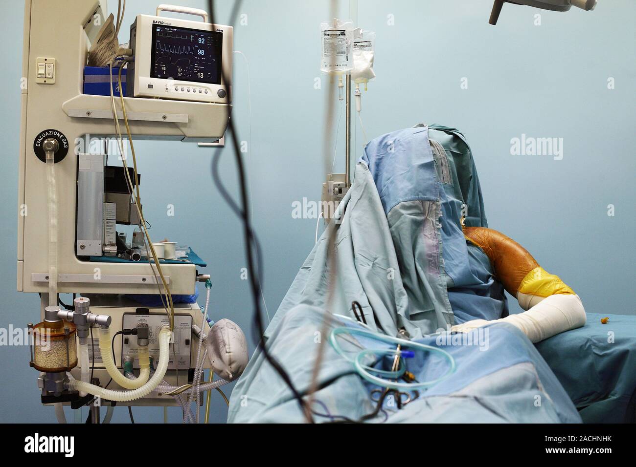 Shoulder operation. Patient prepared in an operating theatre for ...