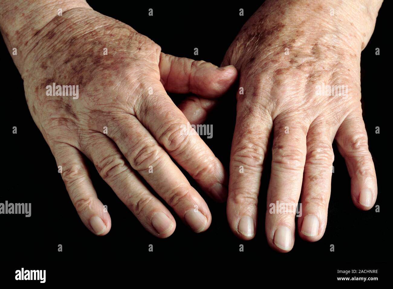 Elderly woman's hands Stock Photo - Alamy