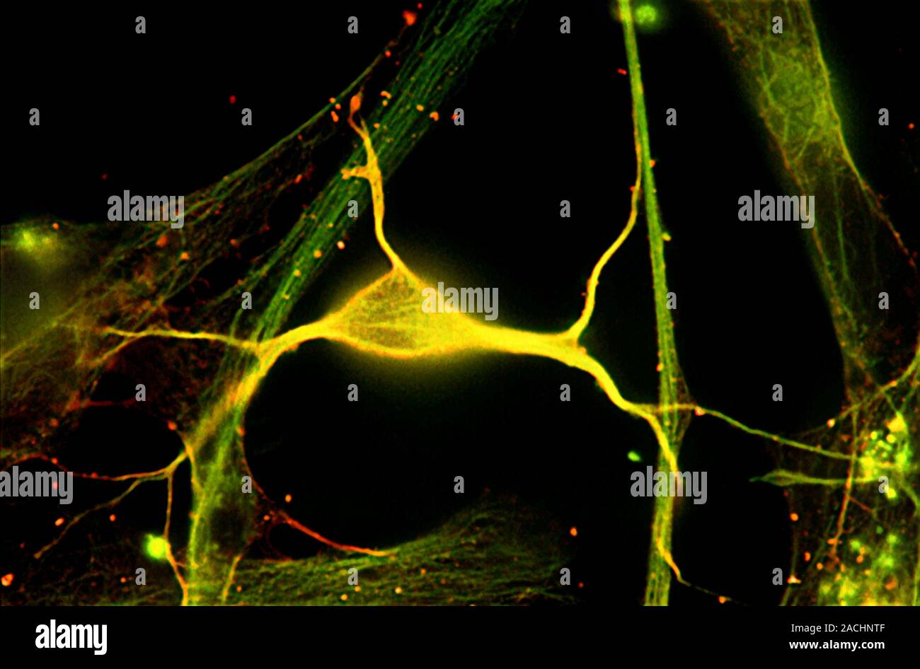 Hippocampal neuron. Fluorescent micrograph of a neuron (nerve cell ...