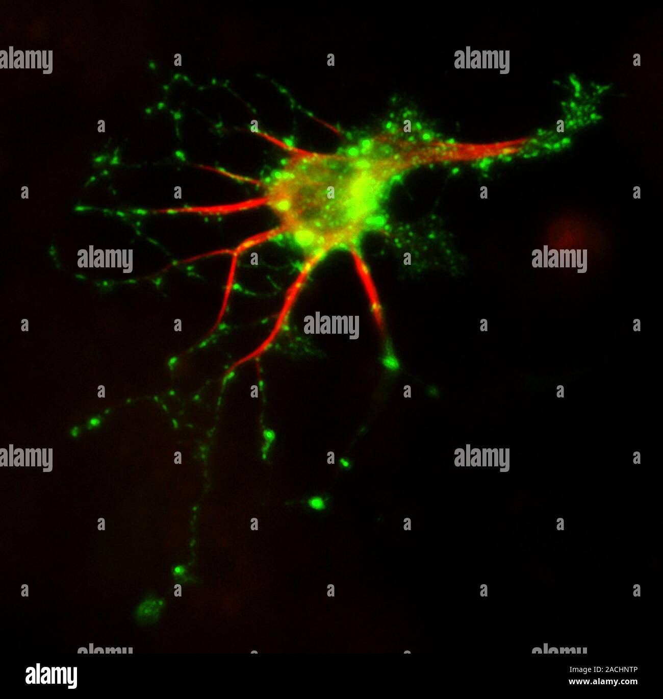 Cell structure. Fluorescent light micrograph of a neuron (nerve cell ...