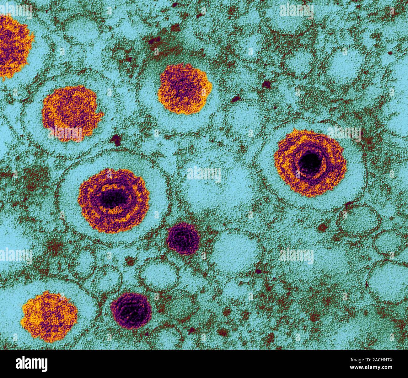 Herpes particles. Coloured transmission electron micrograph (TEM) of ...