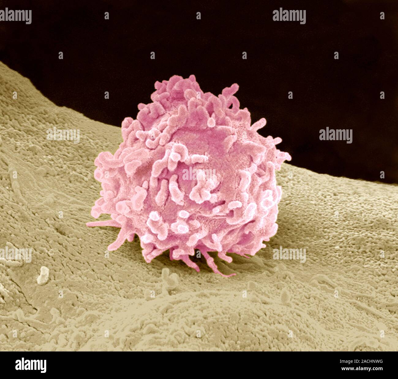 Granulocyte. Coloured scanning electron micrograph (SEM) of a ...