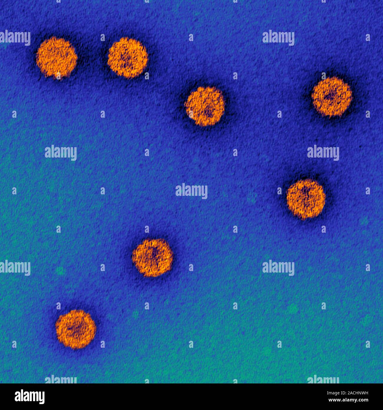 Human papillomavirus particles, coloured transmission electron ...