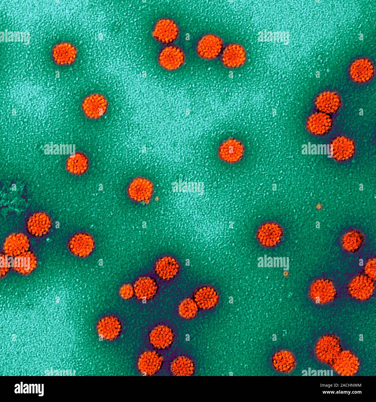 Human papillomavirus particles, coloured transmission electron ...