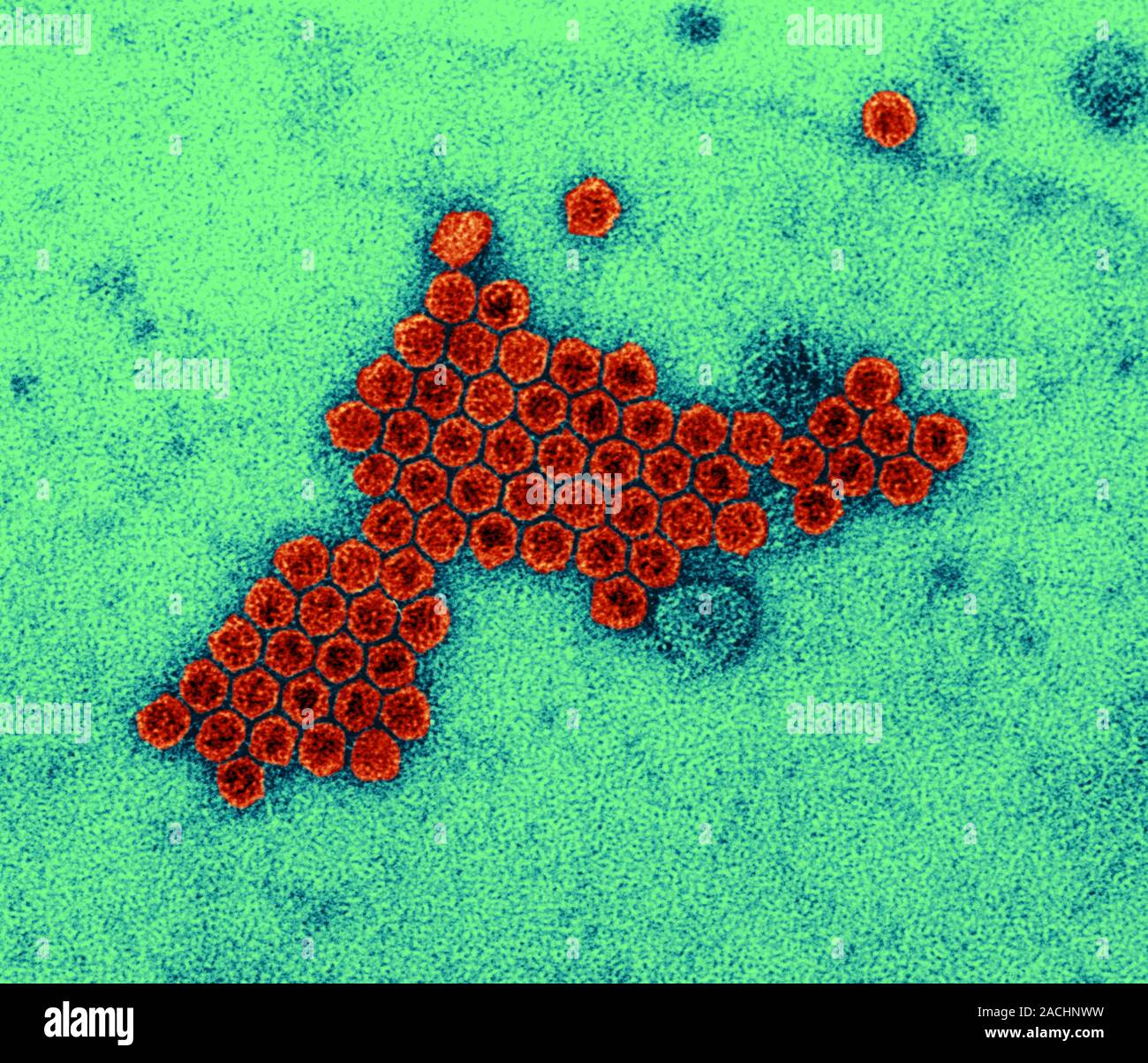 Poliovirus particles. Coloured transmission electron micrograph (TEM ...